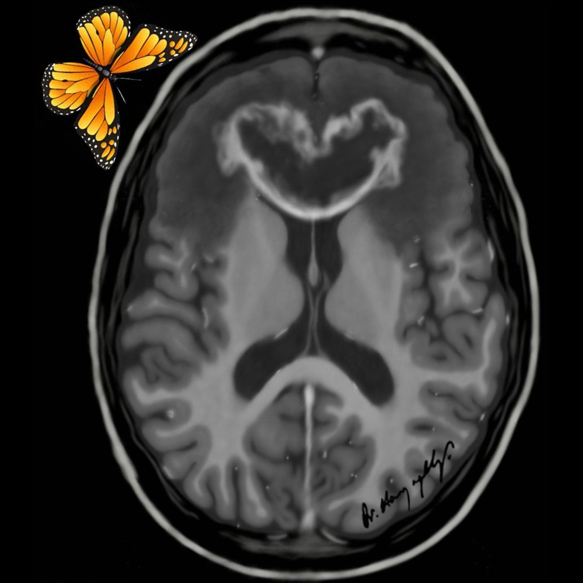 Fantastic animals in the brain!!! “From the tiny tadpole, to the giant ...
