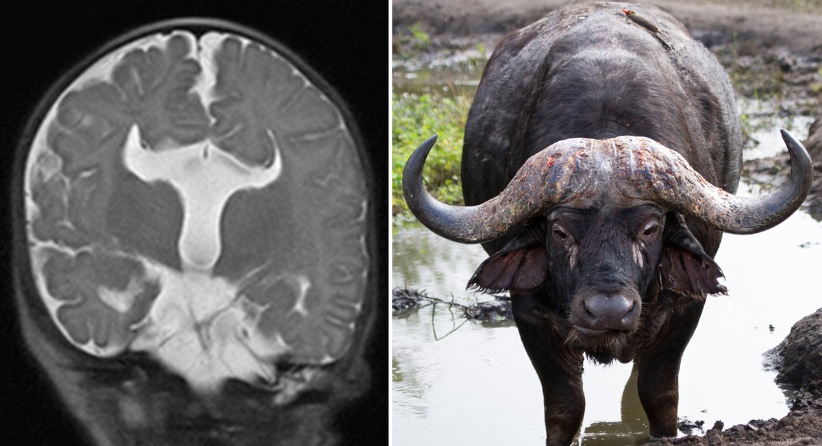 Fantastic animals in the brain!!! “From the tiny tadpole, to the giant ...