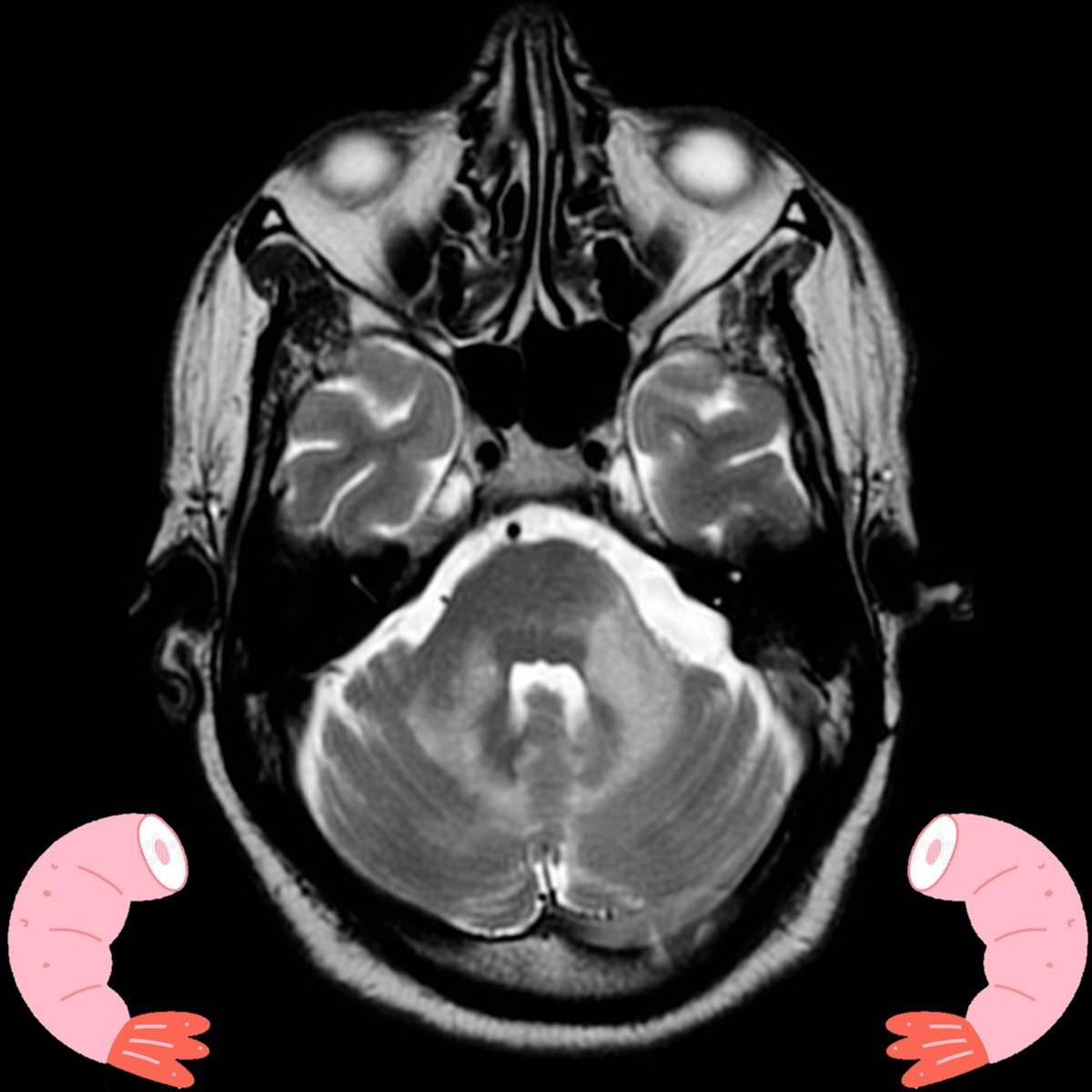 Fantastic animals in the brain!!! “From the tiny tadpole, to the giant ...