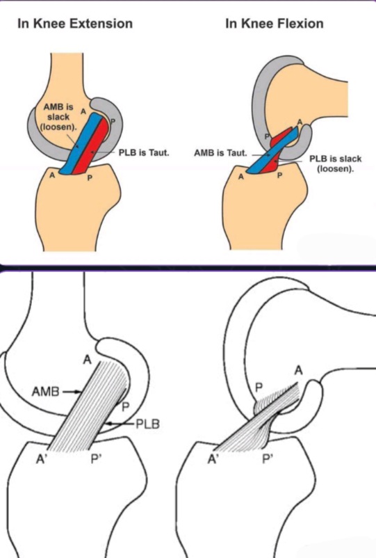 𝐃𝐫.𝐎𝐌𝐈𝐃 𝐁𝐀𝐍𝐃𝐀𝐑𝐂𝐇𝐈, 𝐌.𝐃. on Twitter: "🔴ACL has two main fiber bundles: Anteromedial bundle (AMB ...