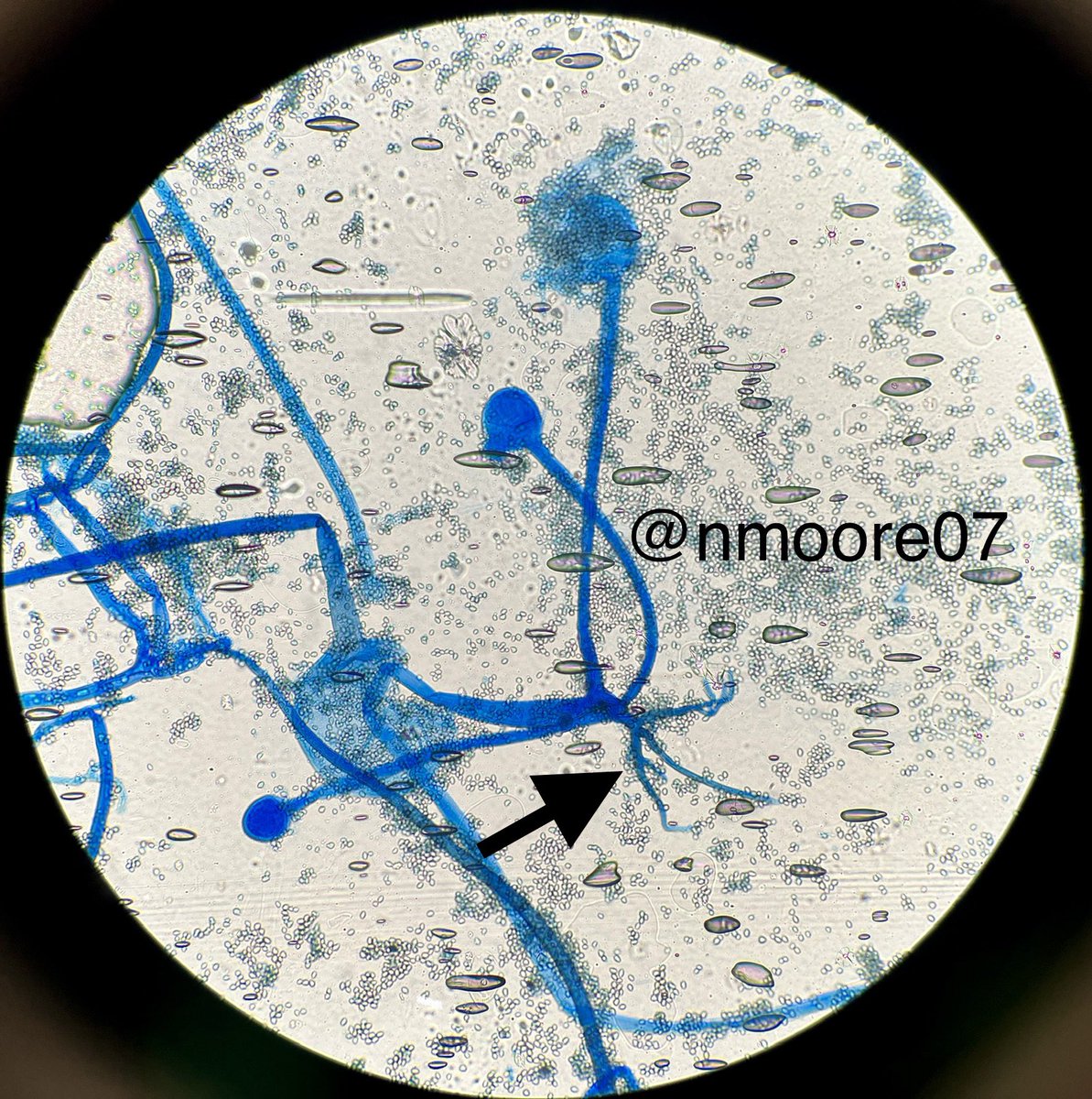 Penicillium Under Microscope 100x