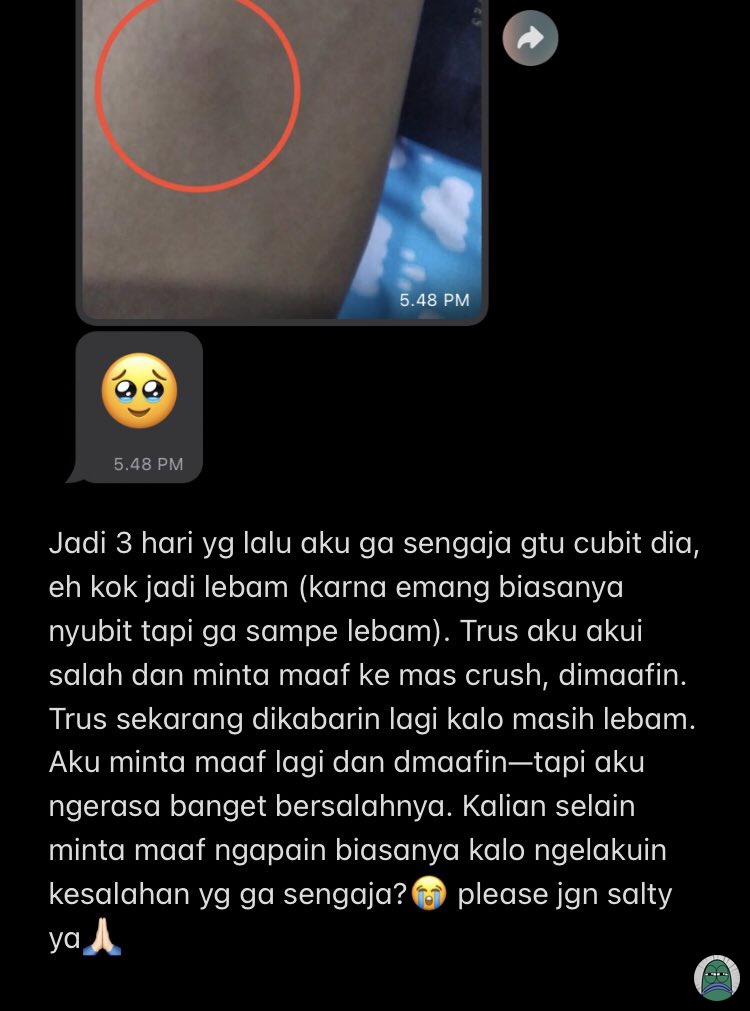 OPEN DM ㅡ Tanyarl 💚 on Twitter: "💚 minta saran, biasanya selain minta maaf kalian ngapain ke doi ...