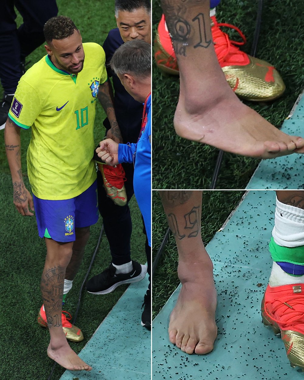 Neymar Fifa World Cup 2022 Injury