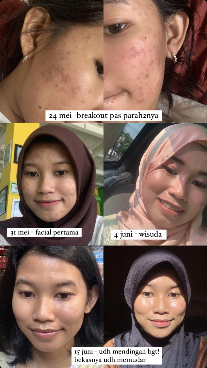 don’t call my name. on Twitter: "@littlefreakU @pondphuwincoty @didinanadadida @ohmybeautybank ...