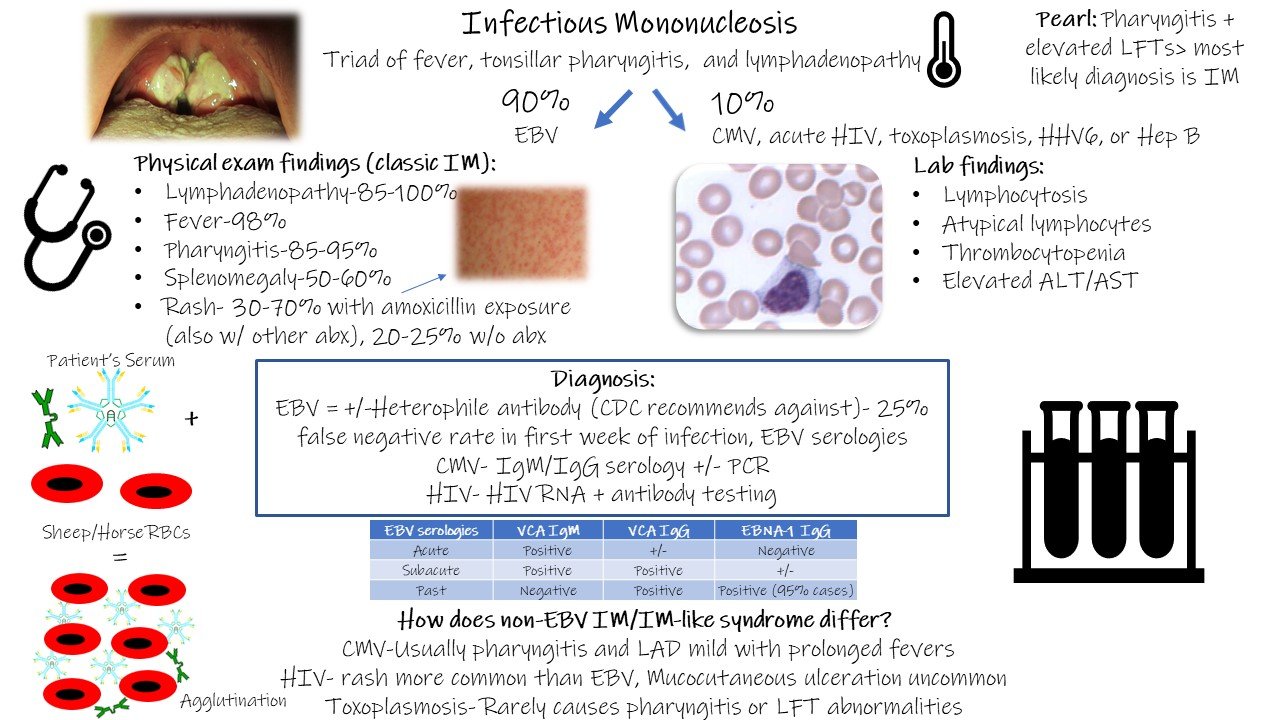 Mononucleosis
