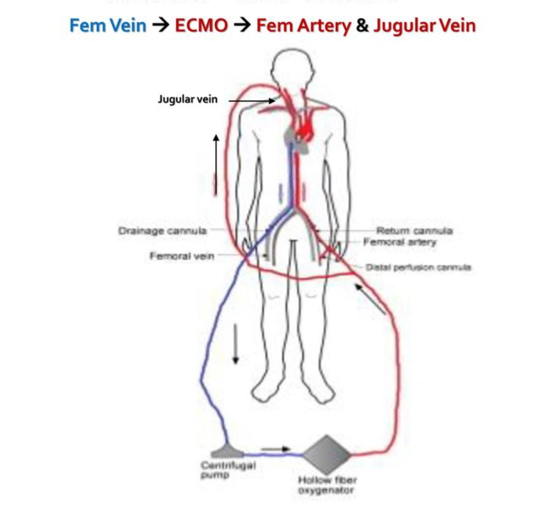Today's short 🧵 is on the Hoffman clamp, a device that may only be of ...