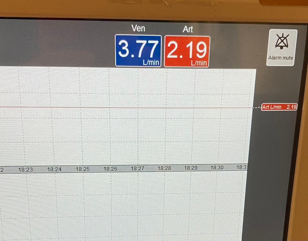 Today's short 🧵 is on the Hoffman clamp, a device that may only be of ...