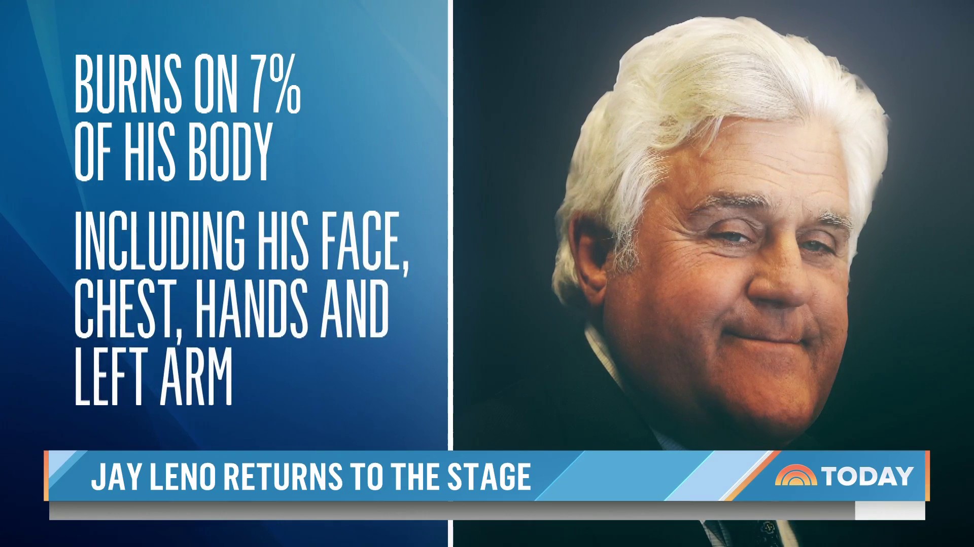 Today On Twitter Jay Leno Returned To The Stage Over The Weekend For