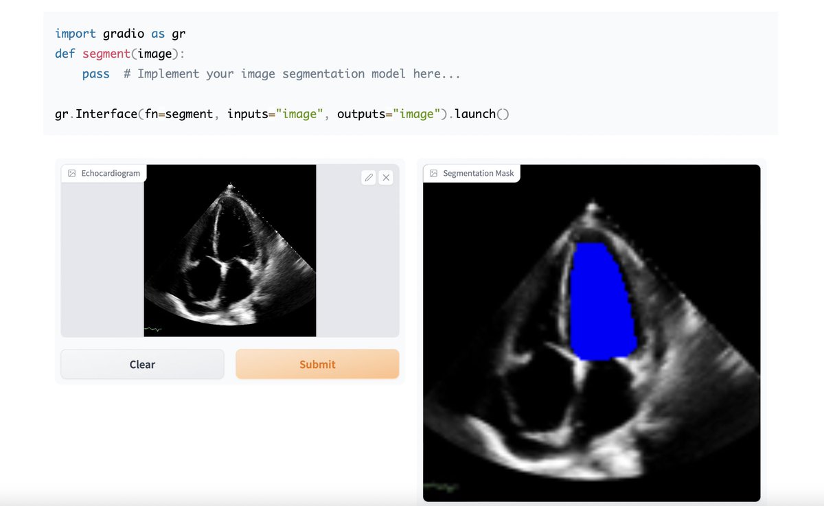 After you train a machine learning model, the BEST way to showcase it ...