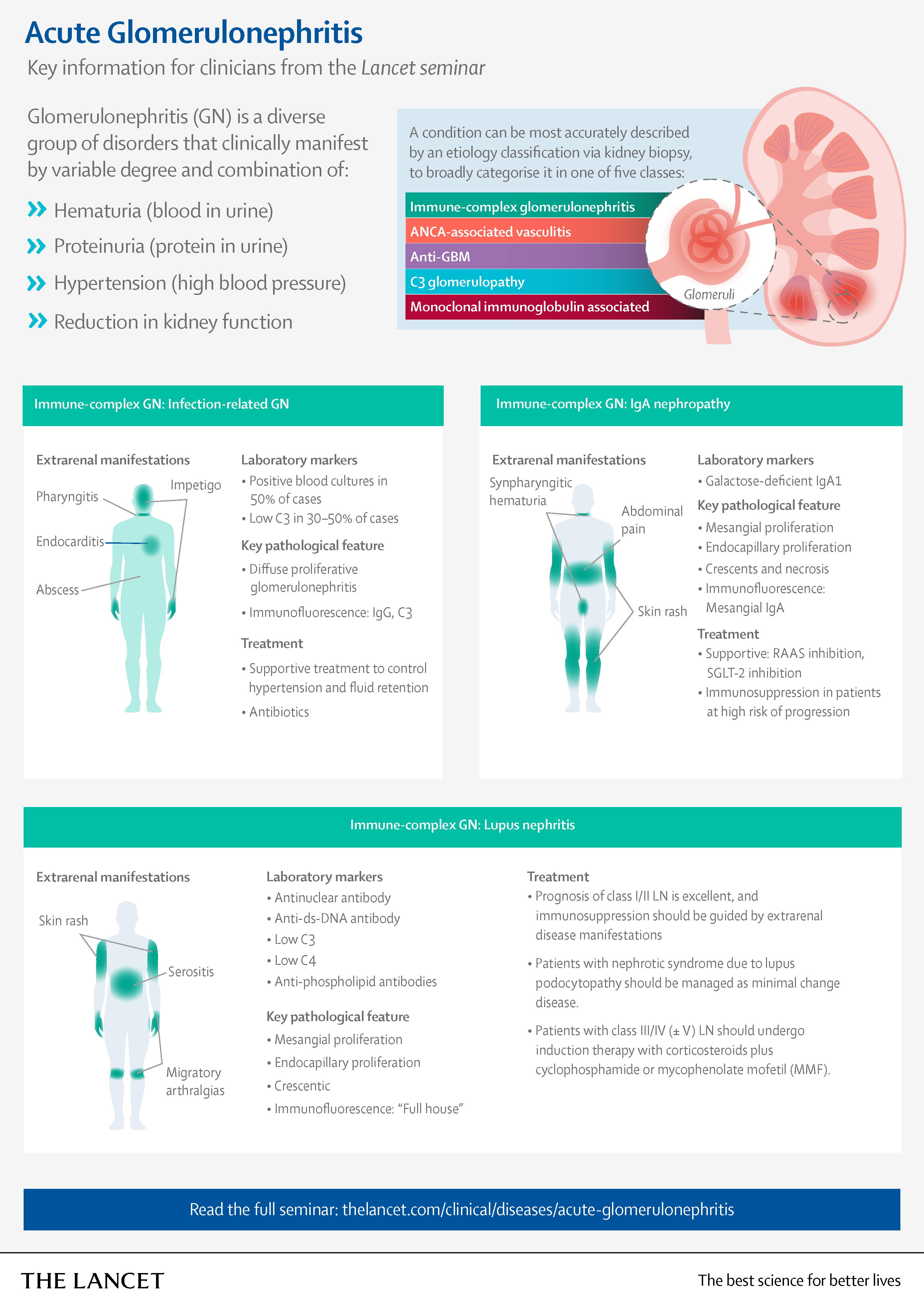Acute Glomerulonephritis Hypocomplementemia At Diagnosis Of