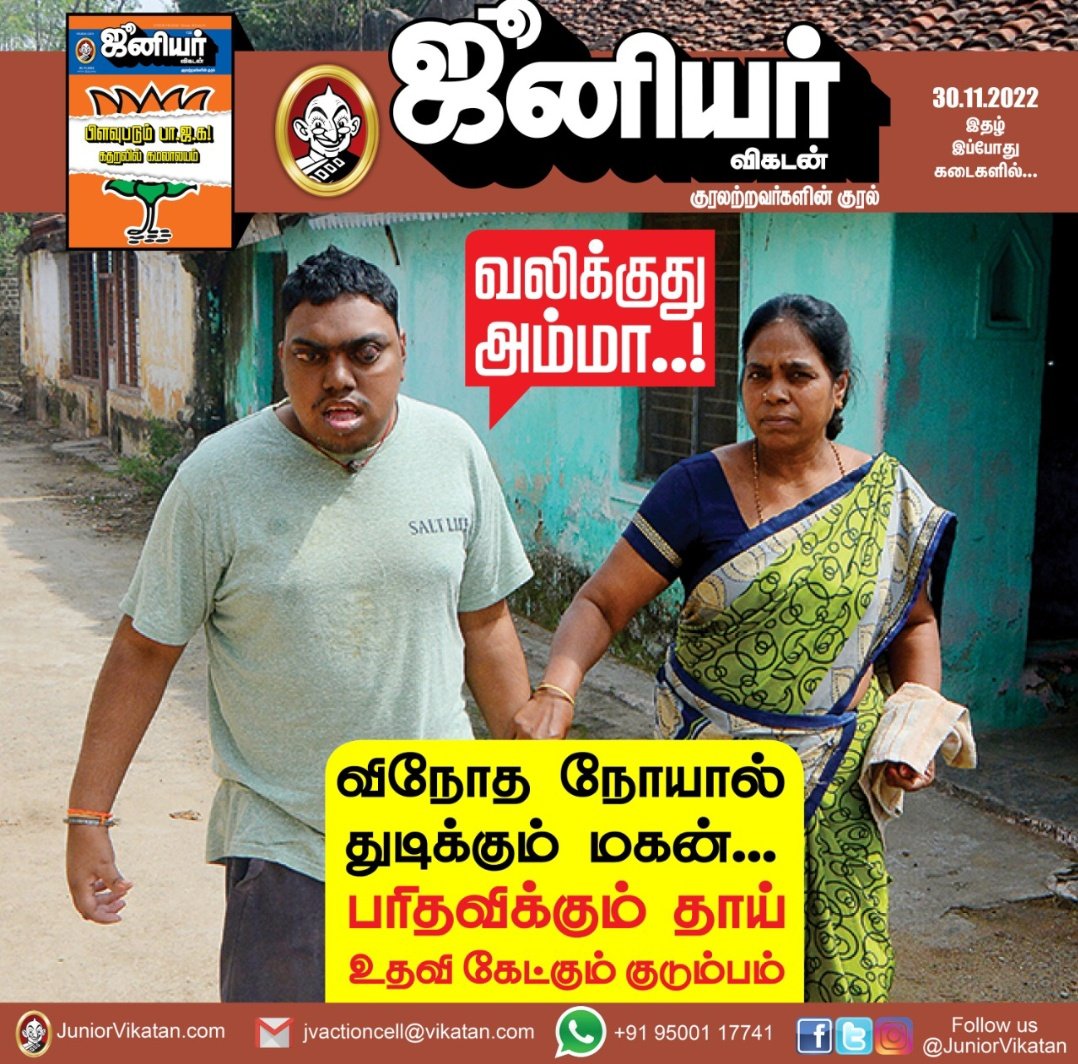 A.P.Nandhakumar MLA on Twitter: "விநோத நோயால் சிறுவன் பாதிக்கப்பட்டதாக விகடனில் செய்தி வெளியானதை ...