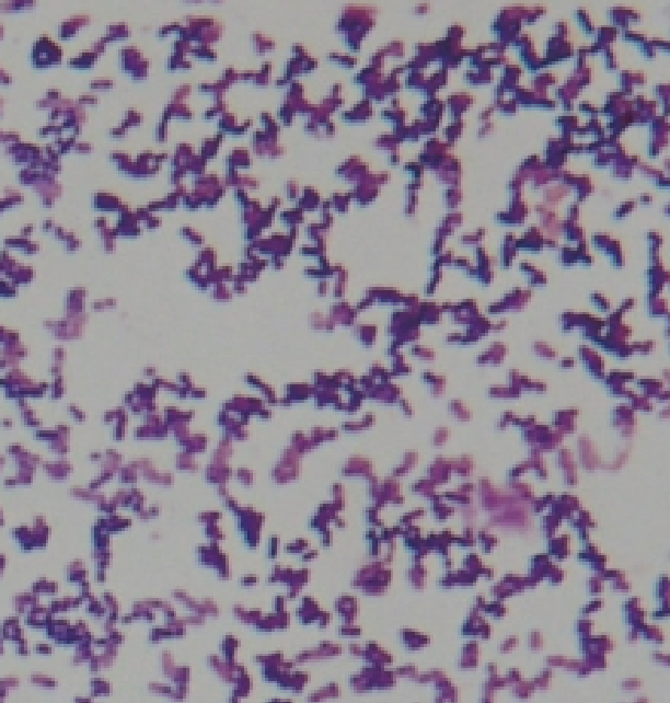 Streptococcus Salivarius Gram Stain
