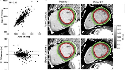 Radiology: Artificial Intelligence on Twitter: "A #DeepLearning Segmentation Pipeline for ...