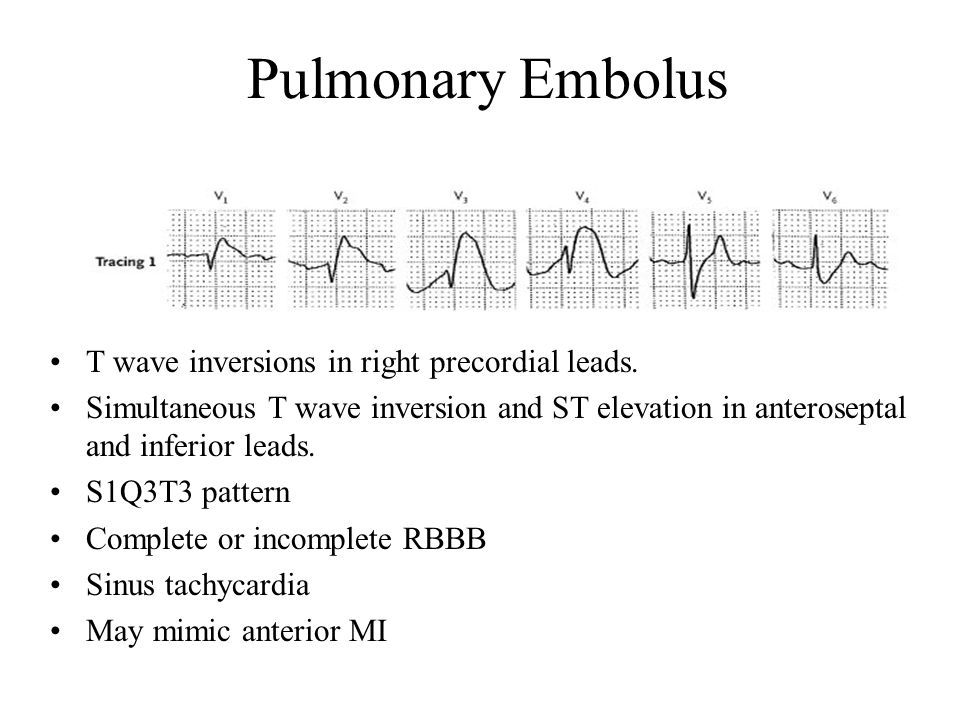 36y/o male who went to the hospital emergency room due to sudden SOB. # ...