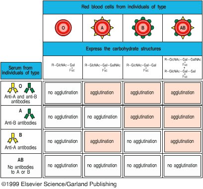 Important ICU teaching case: A woman with AL amyloidosis presents with ...