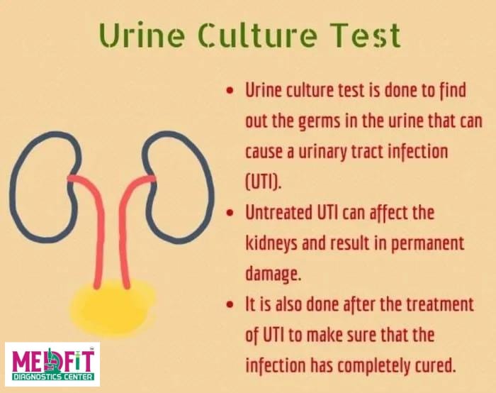 Urine Culture For Uti