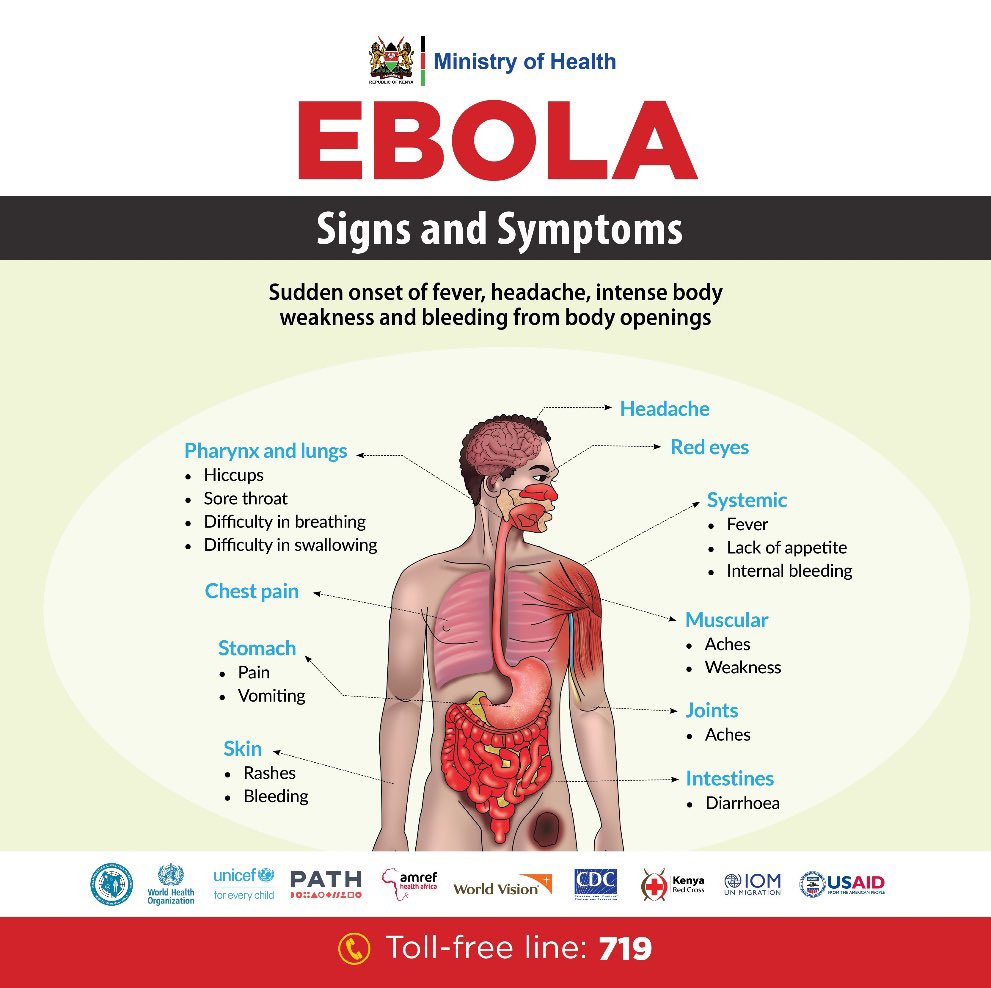 Ebola Virus Disease Symptoms