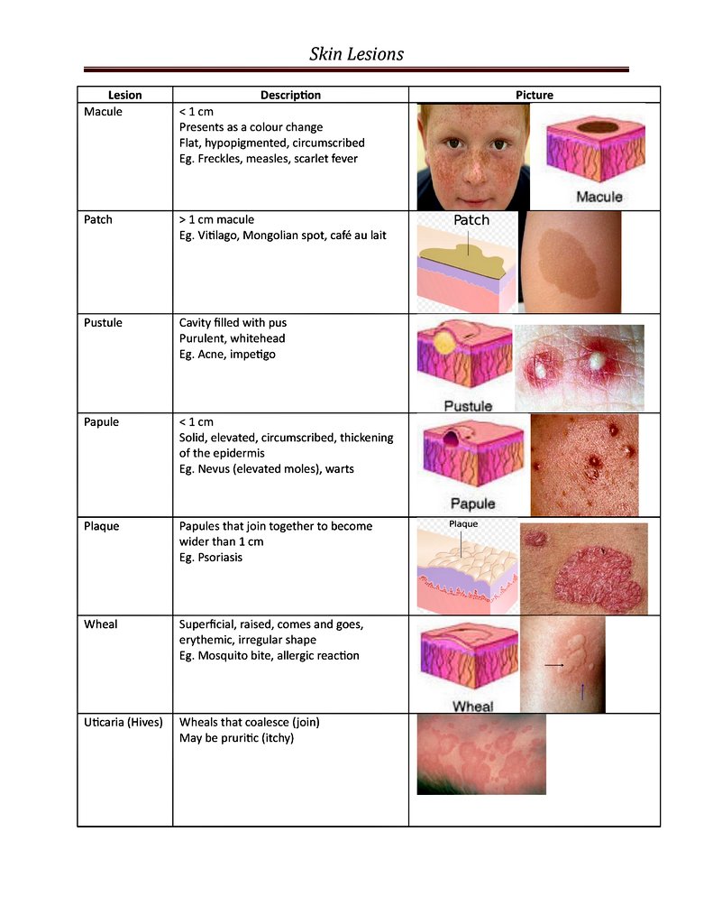 Skin Lesions Chart