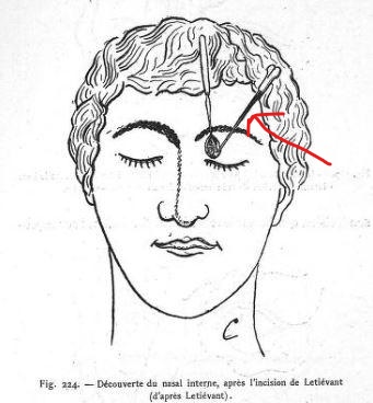 🧵regarding the 'groove director': A weird little instrument we use ...
