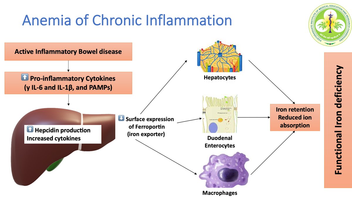 Recently I had an opportunity to speak on Anemia in IBD at the IBD ...
