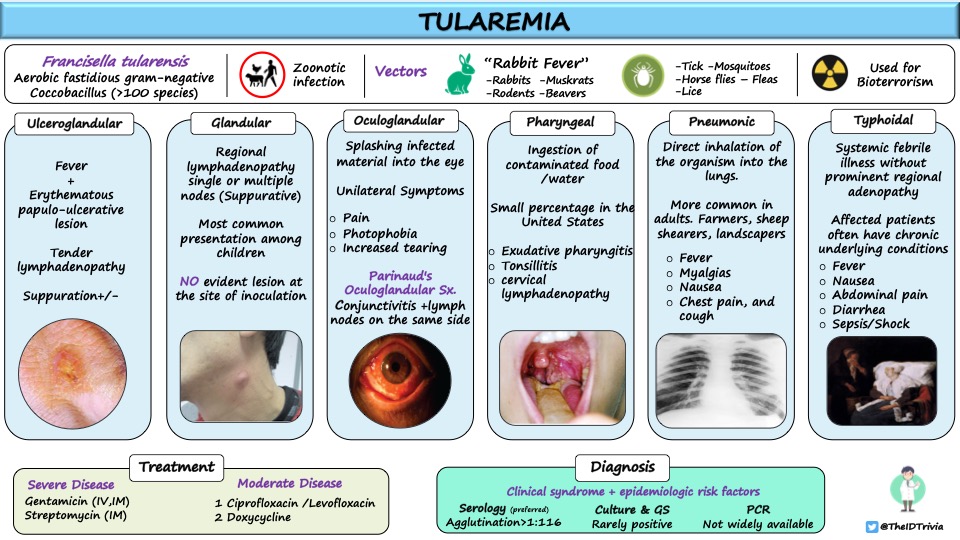 Ulceroglandular Tularemia