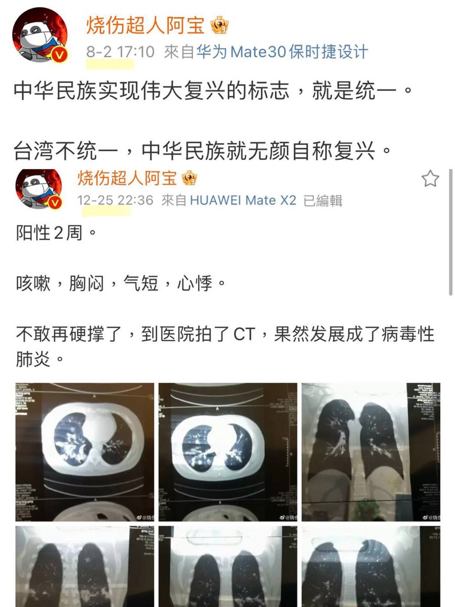 淘喵先生 On Twitter 这个拿着华为手机的小粉红,叫嚣着要 统一”台湾搞 伟大复兴”,结果猝不及防,被党要求打入体内的毒疫苗给撂倒,咳嗽、胸闷、气短、心悸、肺炎,别说 复兴”了,连