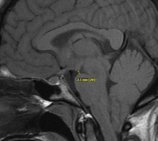 Thread by @NaderDahdaleh on Thread Reader App – Thread Reader App