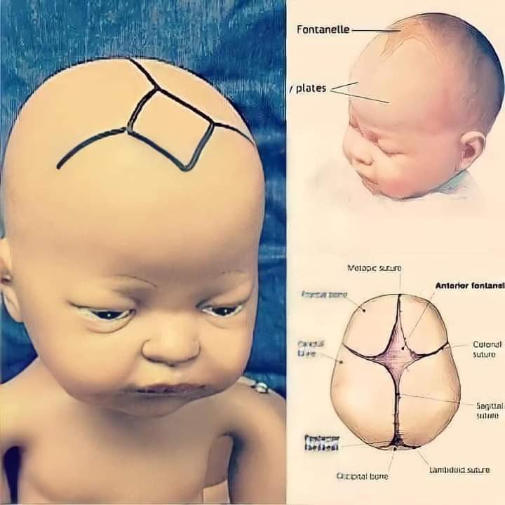 لماذا يجب ألا نلمس قمة رأس طفل حديث الولادة ؟ يولد الطفل بمناطق لينة
