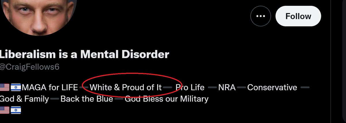 Wholly Hanna on Twitter: "Just another mental midget who's 'proud of his skin' as he has done ...