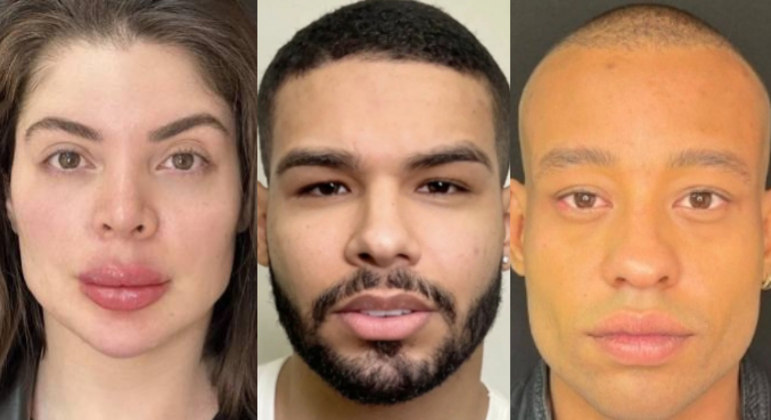 De Gkay a Vyni: famosos que fizeram harmonização facial em 2022 ...