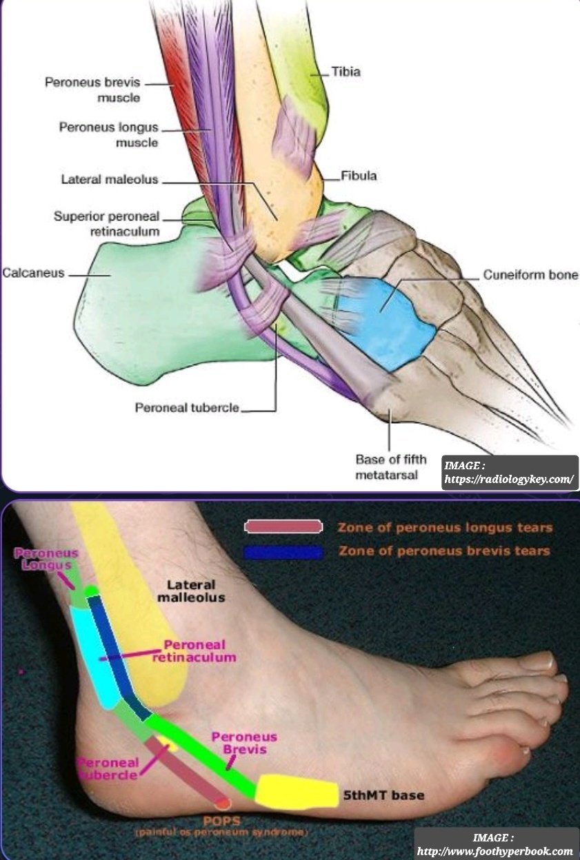 Peroneus Longus Function