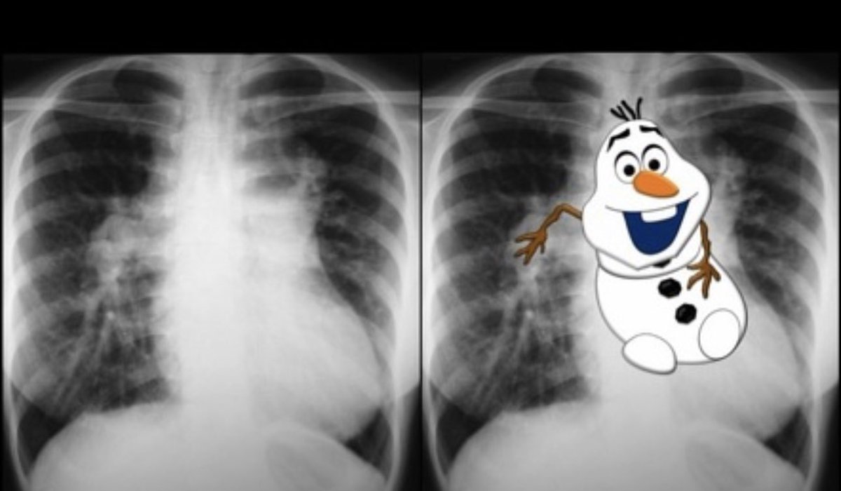 Tony π On Twitter Rt Radrounds What Is The Snowman Sign Indicative