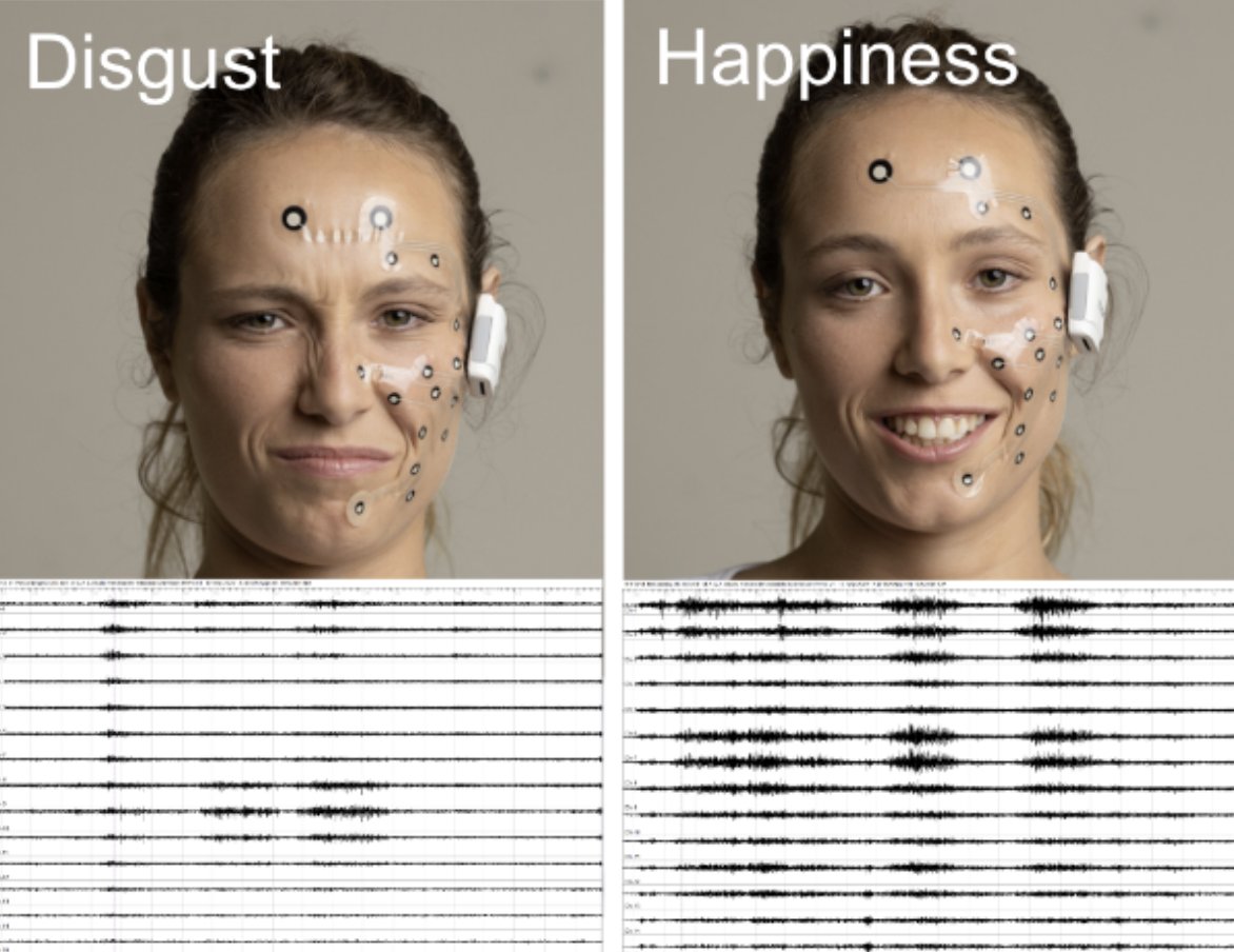 Electromyography Face