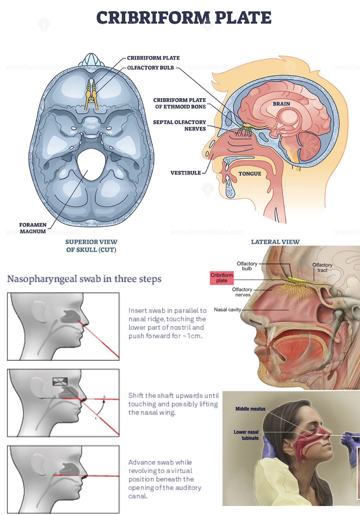Cribriform Plate In Brain