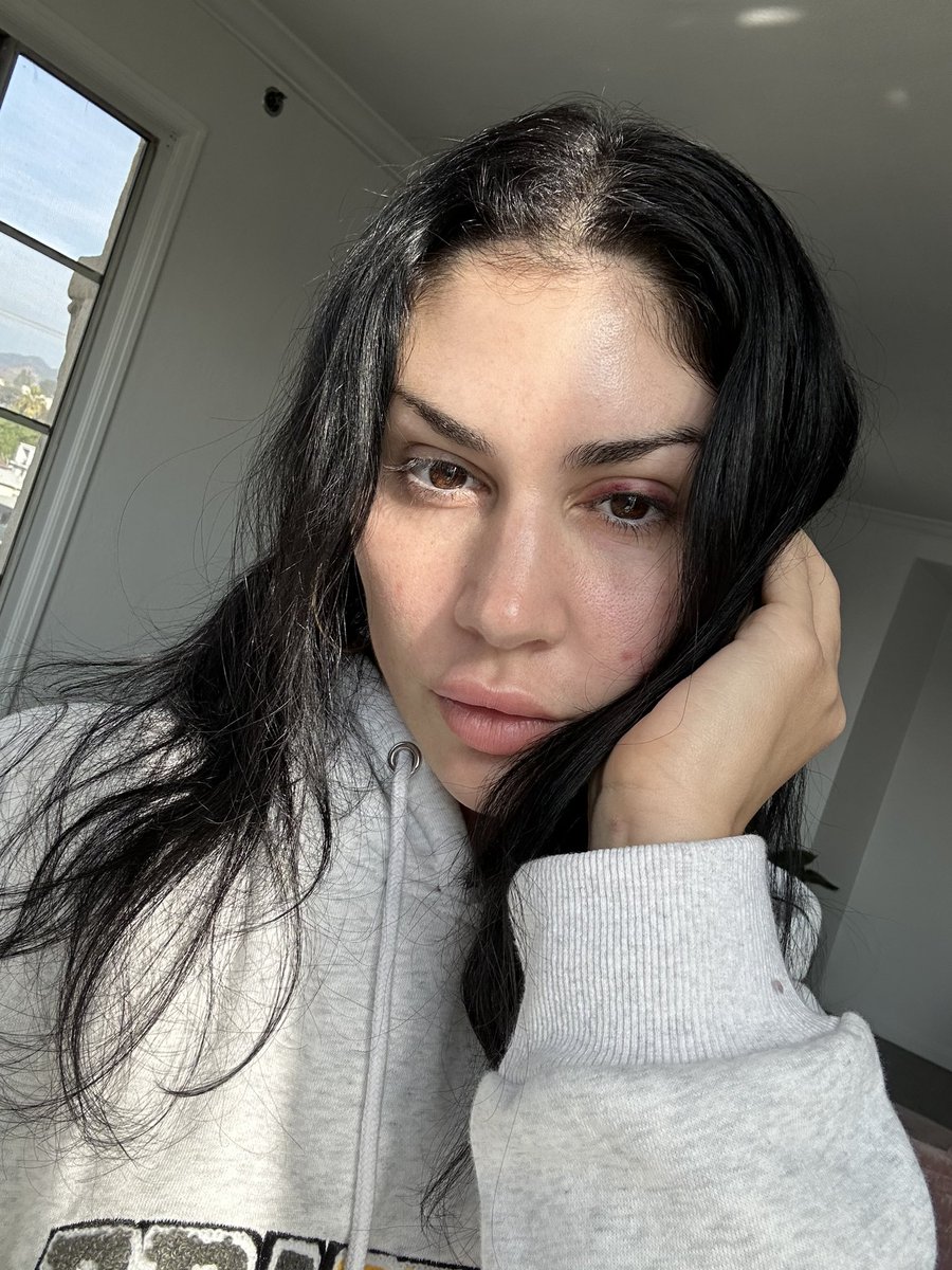 Anal ๐ Go ๐ฅ On Twitter Rt Queeniesateen I Have A Black Eye For The