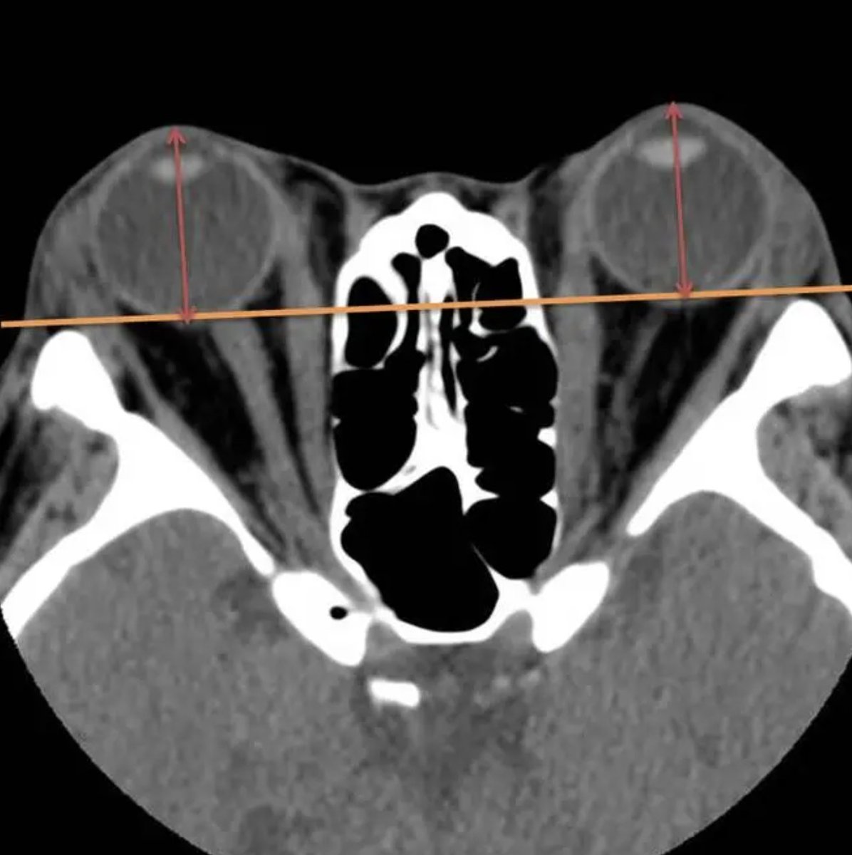 Radrounds Radiology Network On Twitter Patient With History Of
