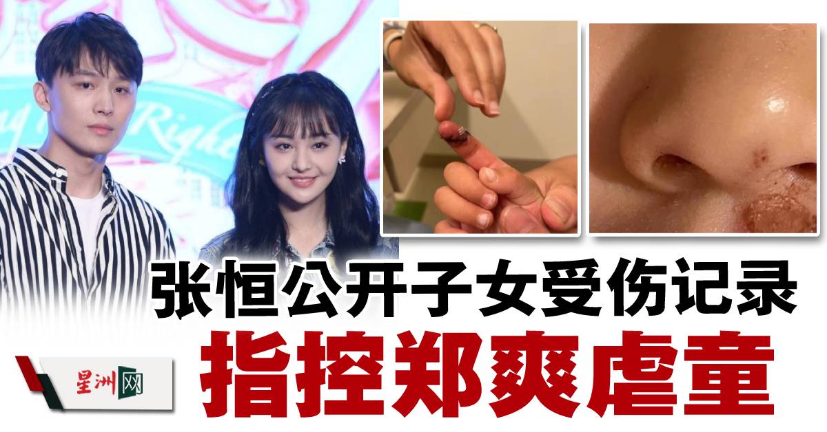 Sin Chew Daily 星洲日報 on Twitter: "目前只有男方说词。 #郑爽 #张恒 #星洲日报 #sinchew https://sinchew.com.my/?p ...