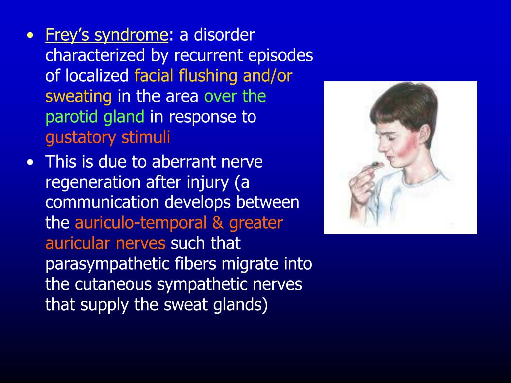 Freys Syndrome