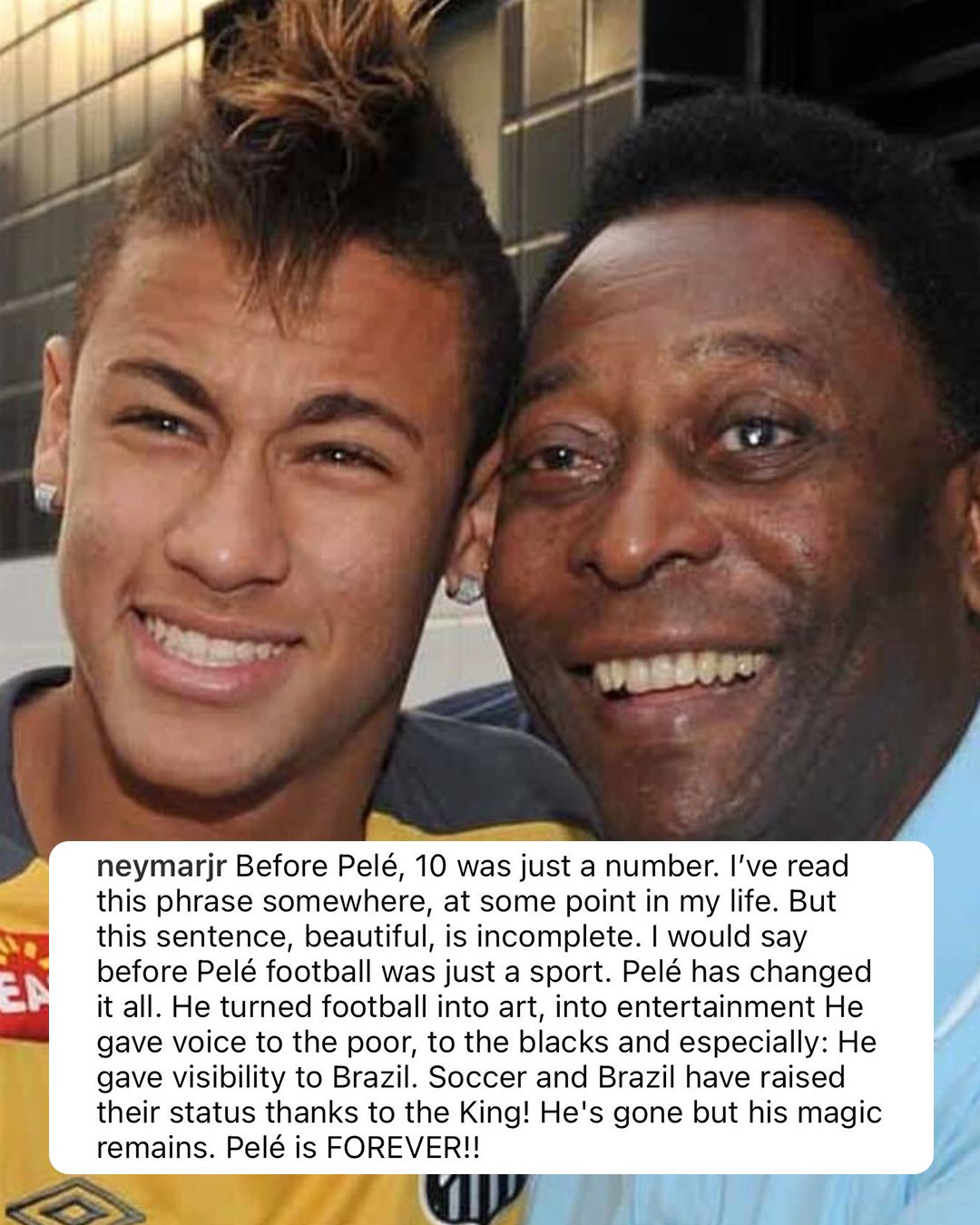 Neymar Before And After