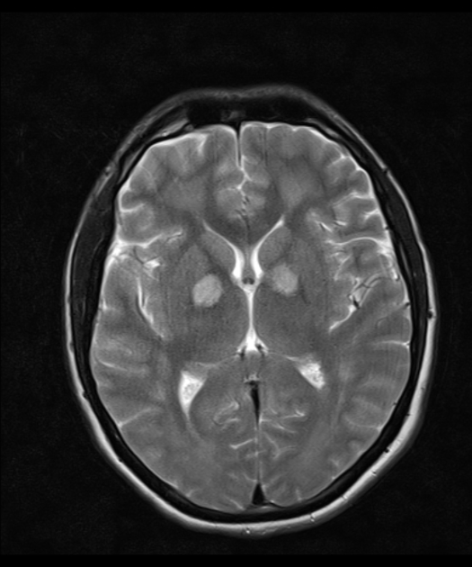 I've decided to start a series of high-yield Step 1 review tweetorials ...