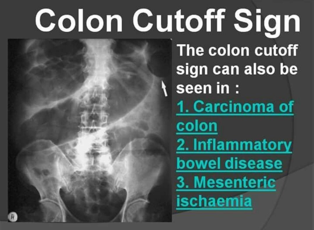 Thread by @Sthanu5 on Thread Reader App – Thread Reader App