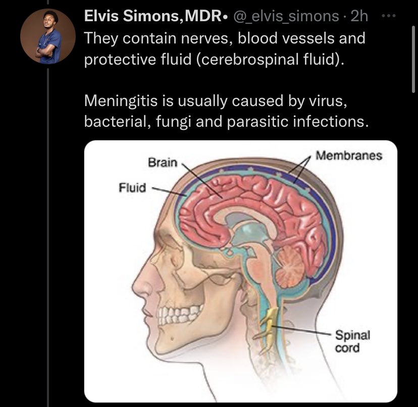 Thread by @_elvis_simons on Thread Reader App – Thread Reader App
