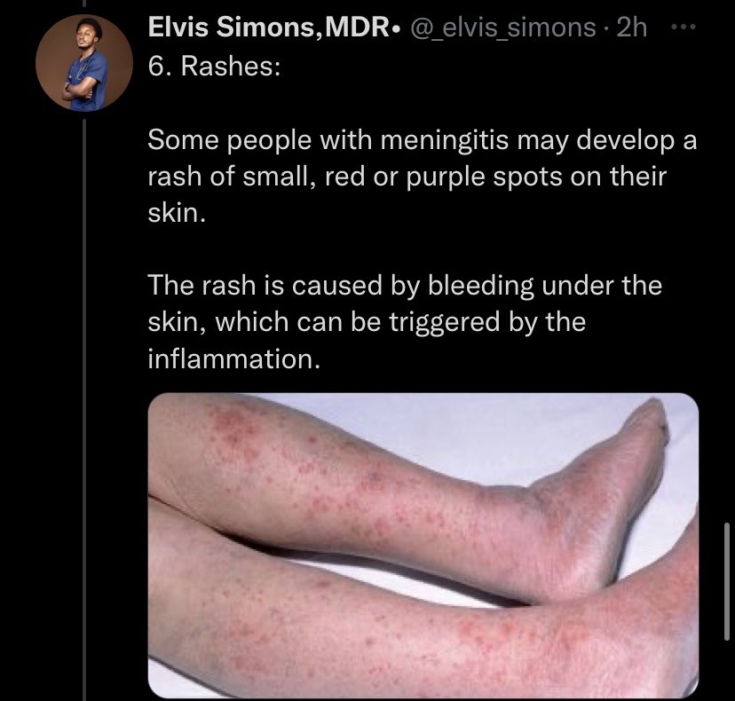 Thread by @_elvis_simons on Thread Reader App – Thread Reader App