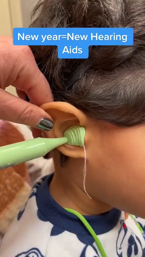 Taking a deep impression of the ear for the production of hearing aids ...