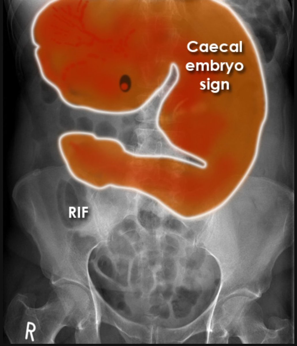 Thread by @Sthanu5 on Thread Reader App – Thread Reader App