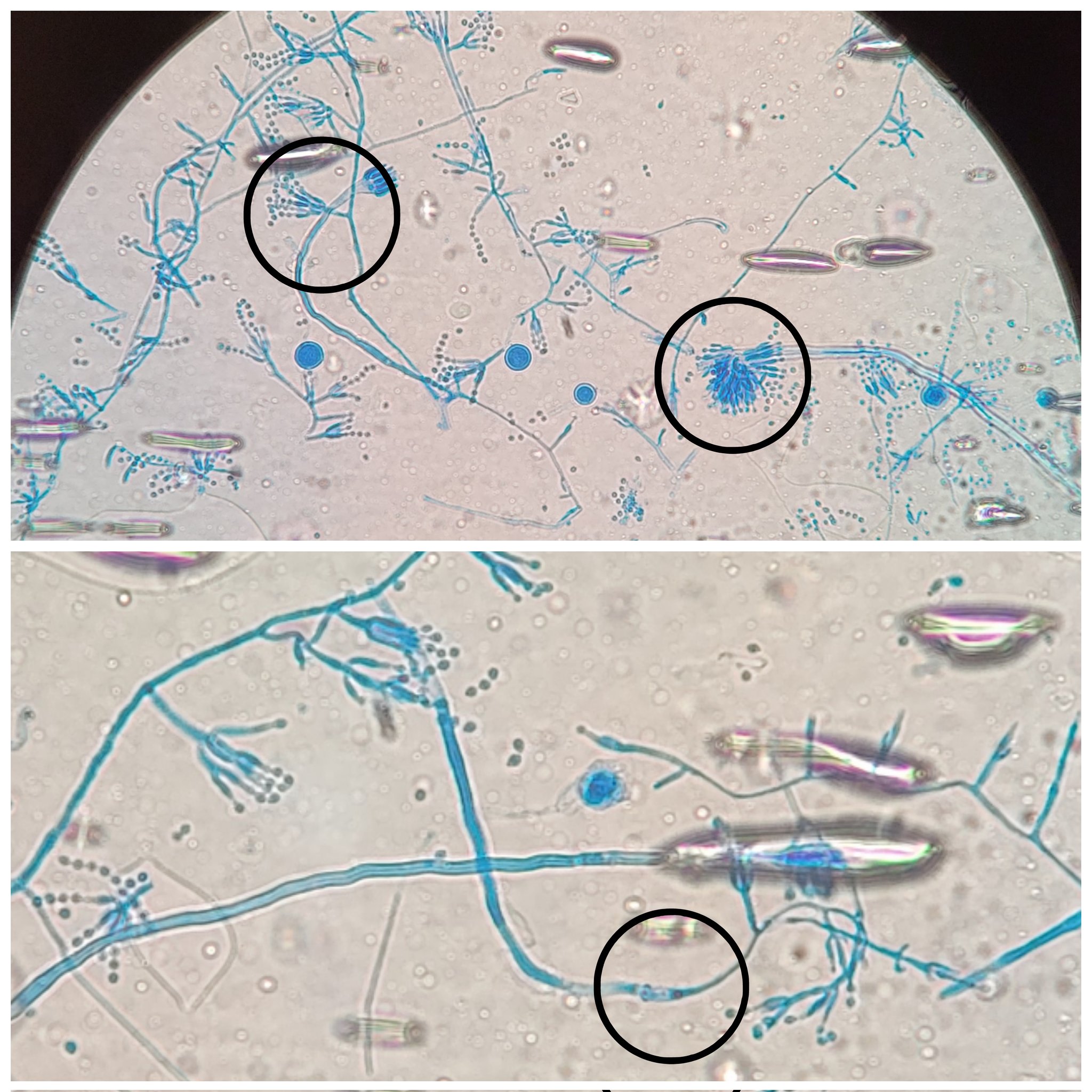 Aspergillus Versicolor Morphology