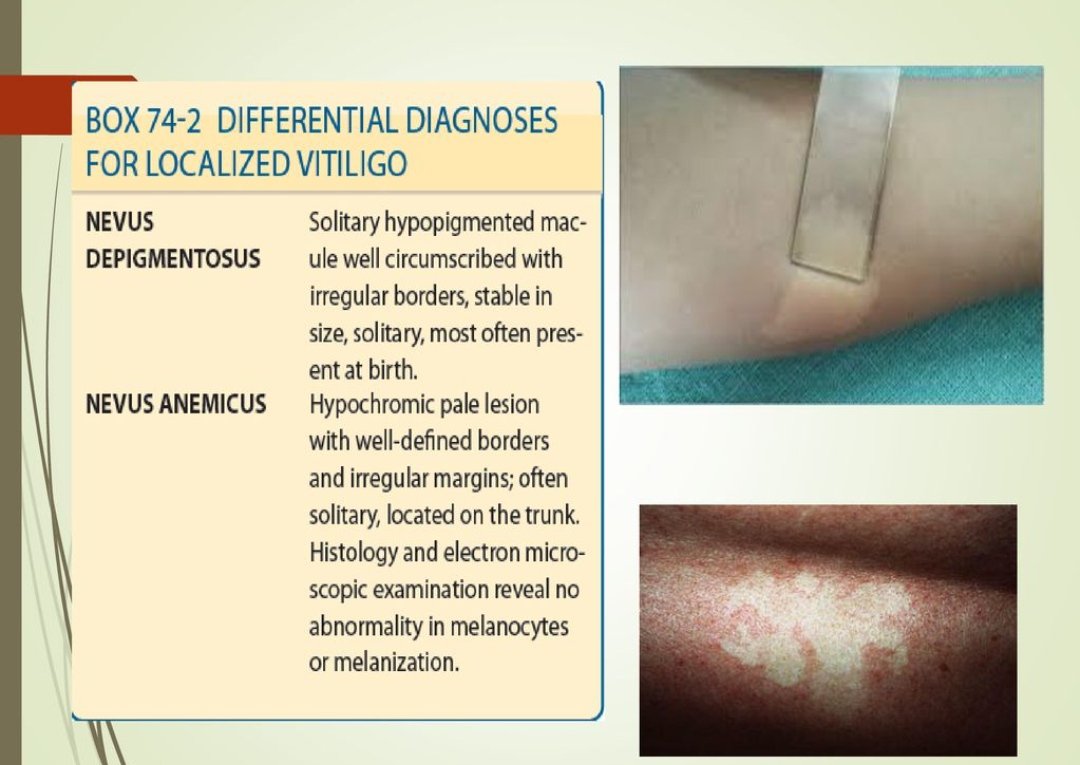 Nevus Anemicus Mosaizismus Und Epidermale Nävi | SpringerLink