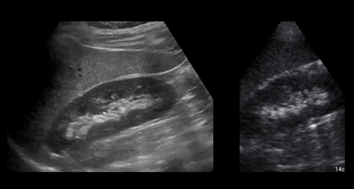 @AlanYuNeph @Rajiv_Sinanan @khaycock2 @TaweevatA ⏺️Image quality is not ...