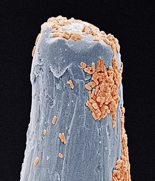 microscopic images. on Twitter: "electron microscope picture of bacteria on the tip of a needle ...