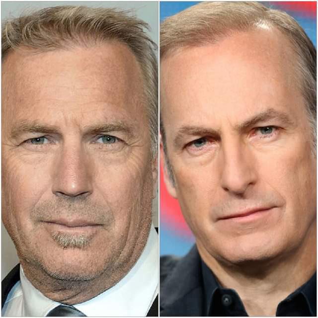 Kevin Costner Hair Plugs